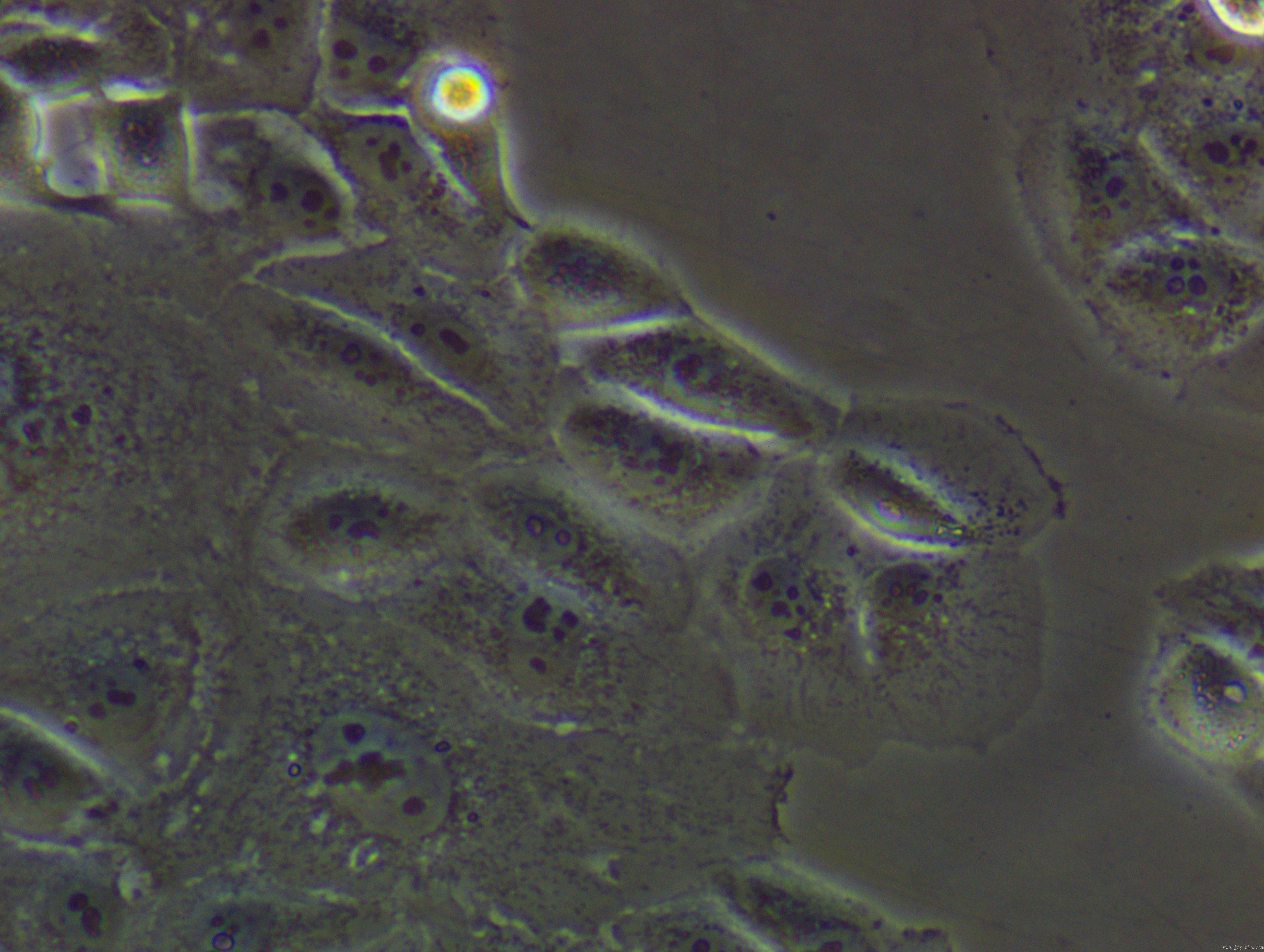 HuCC-T1（人胆管癌细胞） - 上海逐一生物科技有限公司