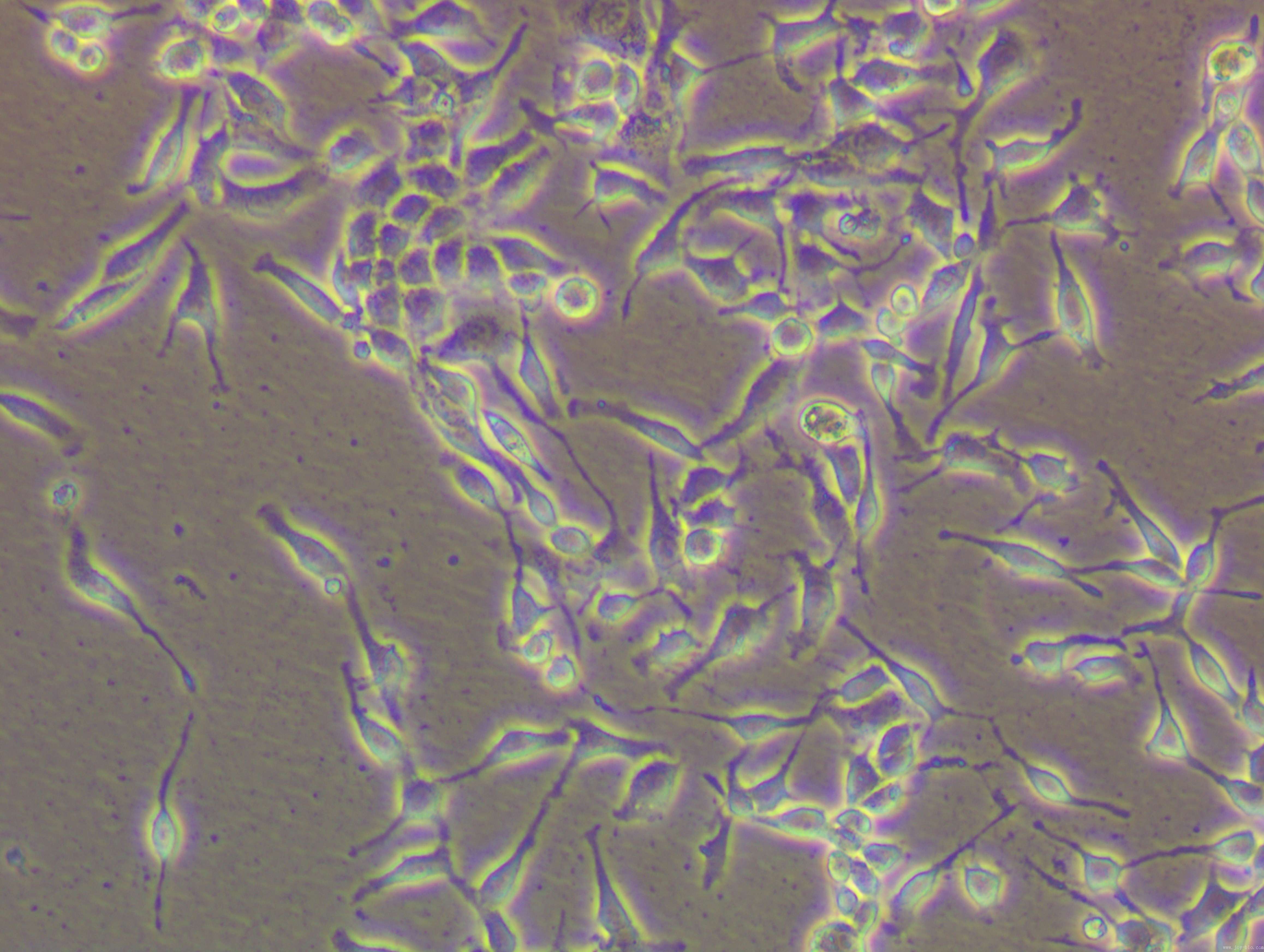 AsPC-1（人转移胰腺腺癌细胞） - 上海逐一生物科技有限公司